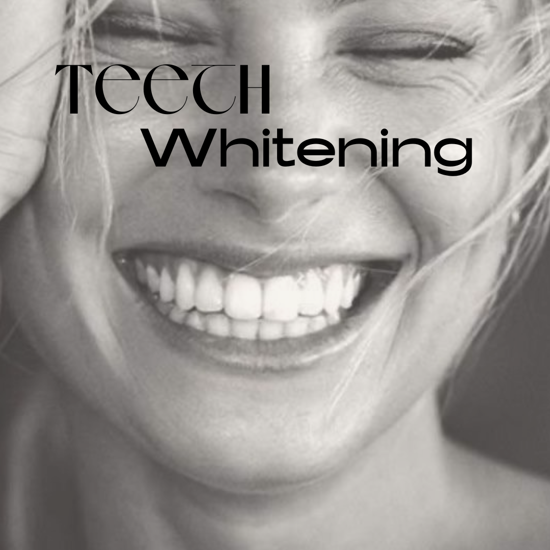 Smile Bar - Elevate Your Smile