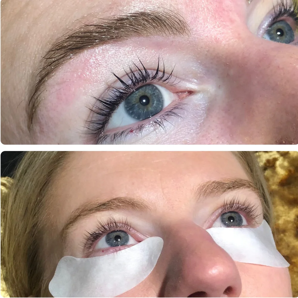 Our Approach — Indulgence Beauty Clinic