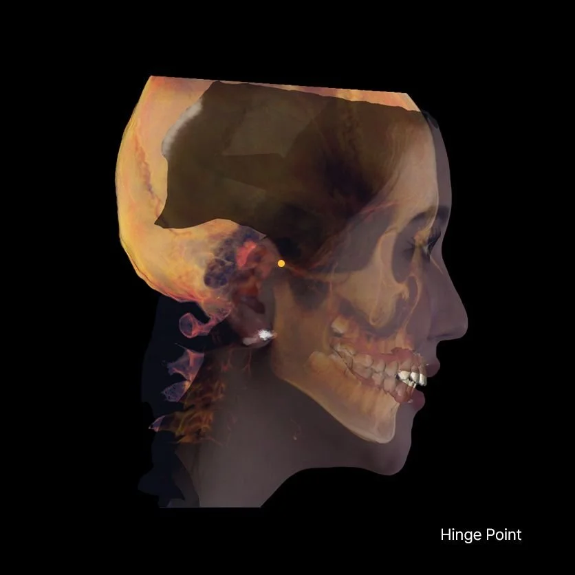 General 5 — Ray America