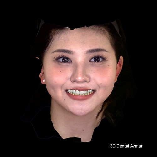 General 5 — Ray America