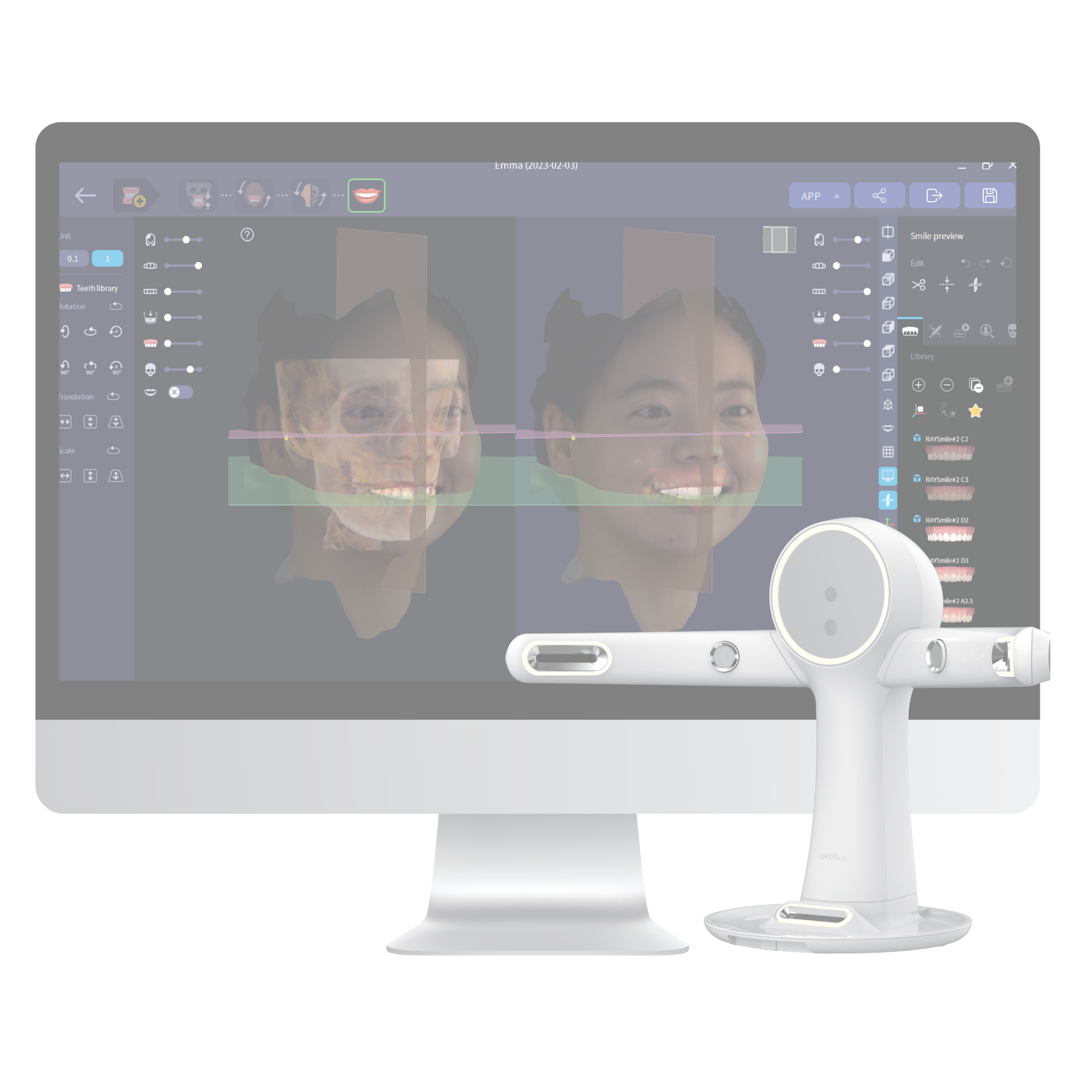 RAYFace — Ray America