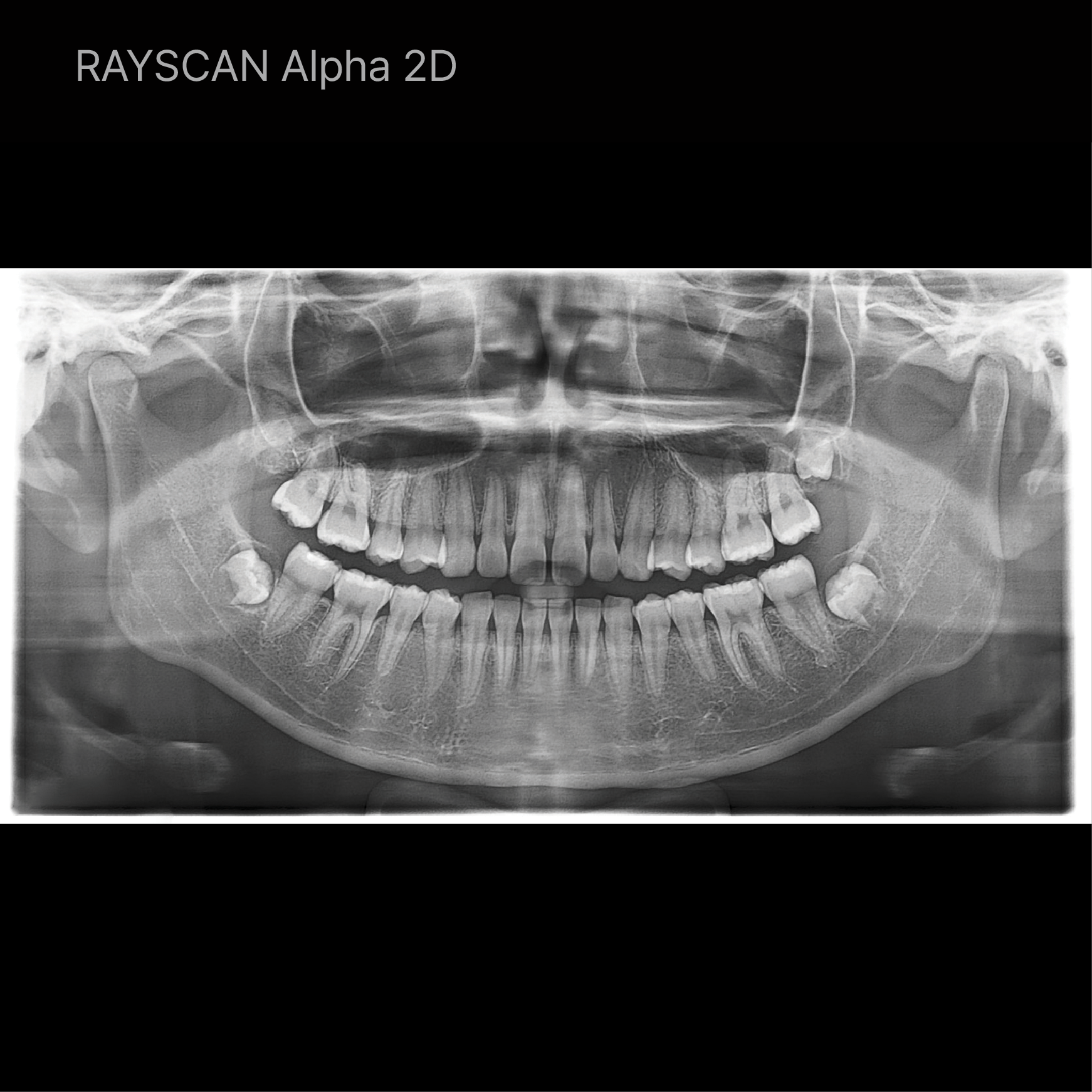 Rayscan Alpha 2D — Ray America