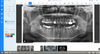 SmartDent Software | Enhance Your Dental Practice Today — Ray America