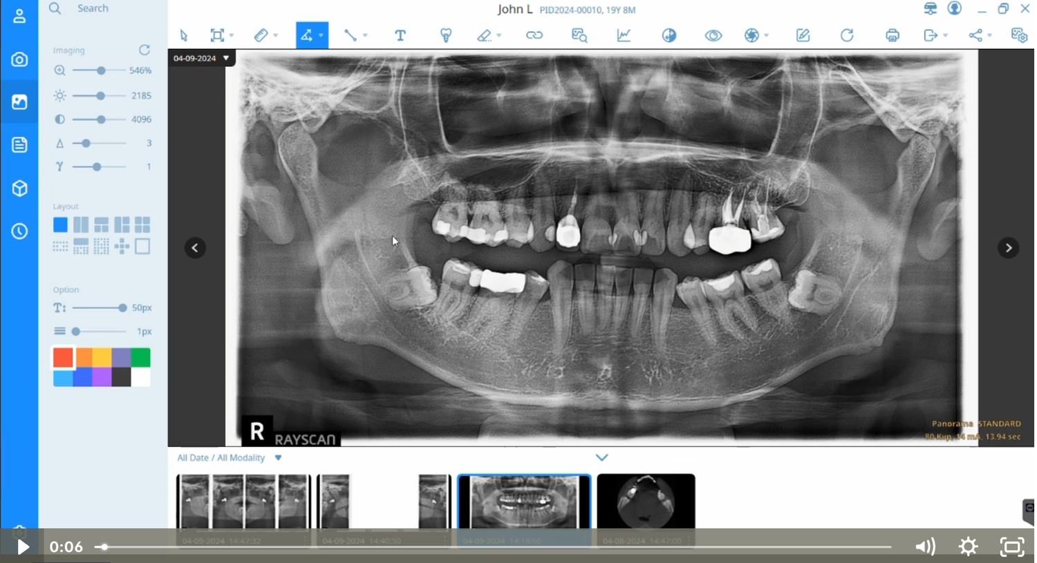 SmartDent Software | Enhance Your Dental Practice Today — Ray America