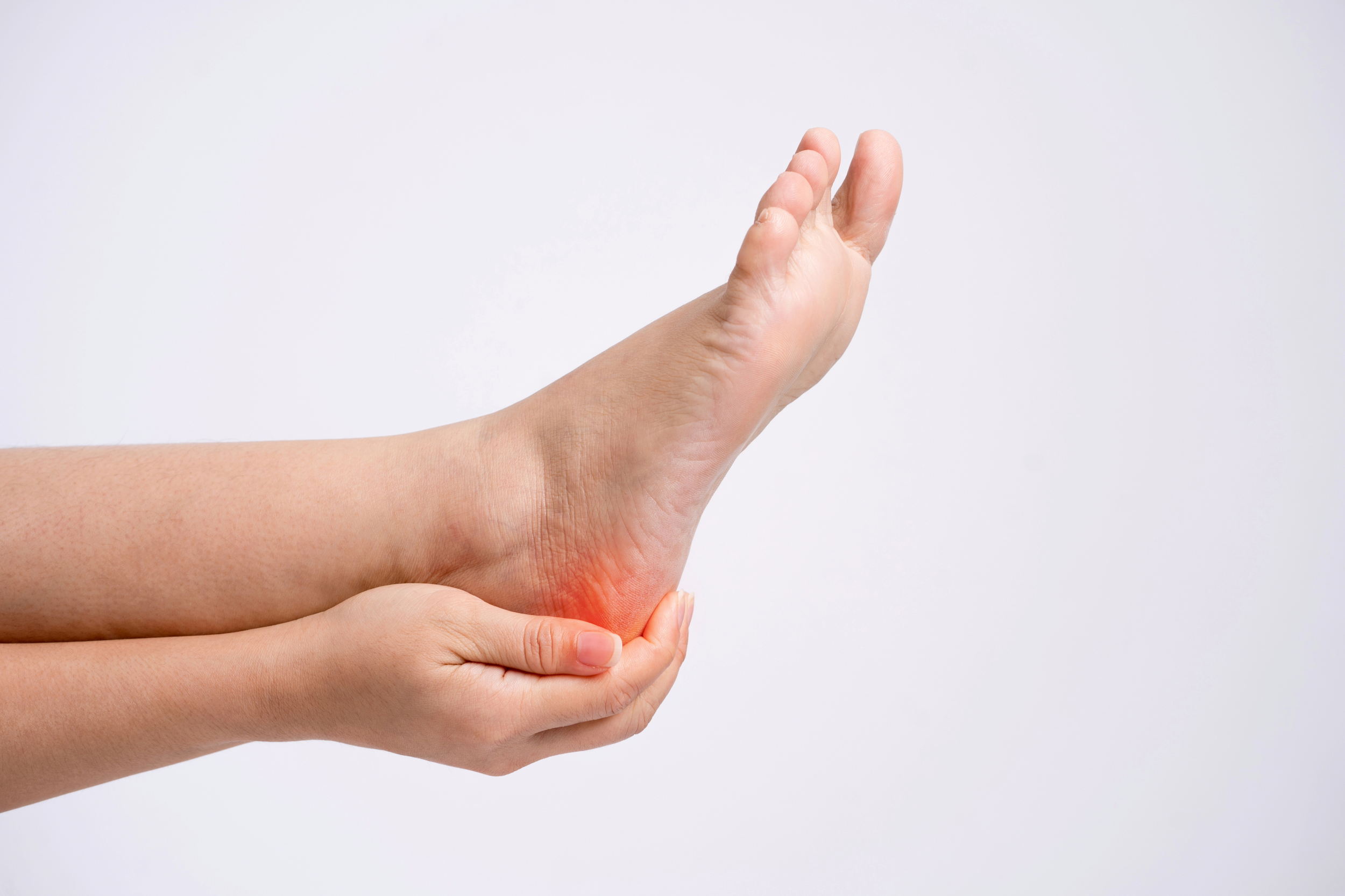 How to Prevent and Treat Cracked Heels: Foot Care Tips from a Foot ...