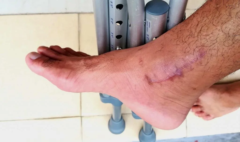 Foot and Ankle Surgery — Doctor's Inc.