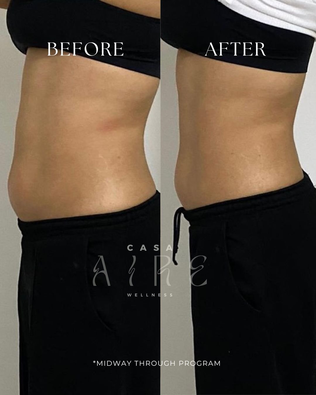 Luxury Wellness Spa in Dubai | Best Facials & Selfcare Experience