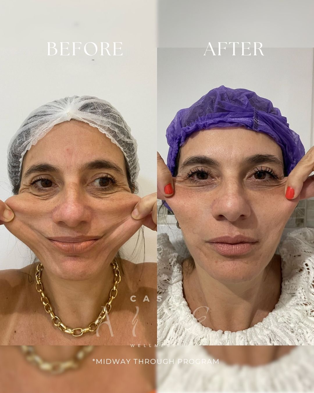 Luxury Wellness Spa in Dubai | Best Facials & Selfcare Experience