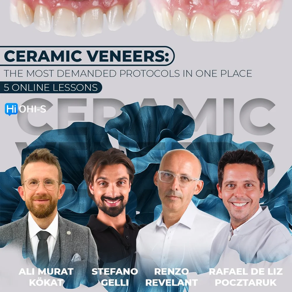 Ceramic Veneers: the most demanded protocols in one place — Explore Dentistry