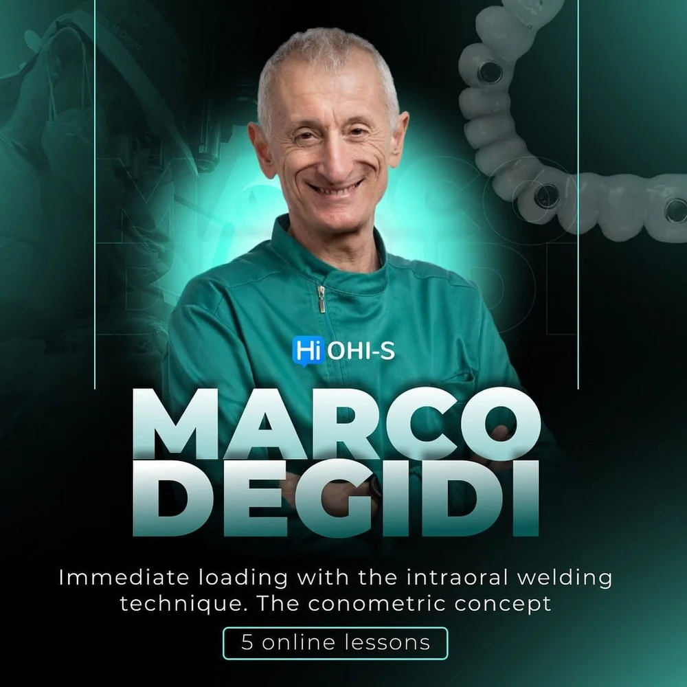 Immediate loading with the intraoral welding technique. The conometric ...