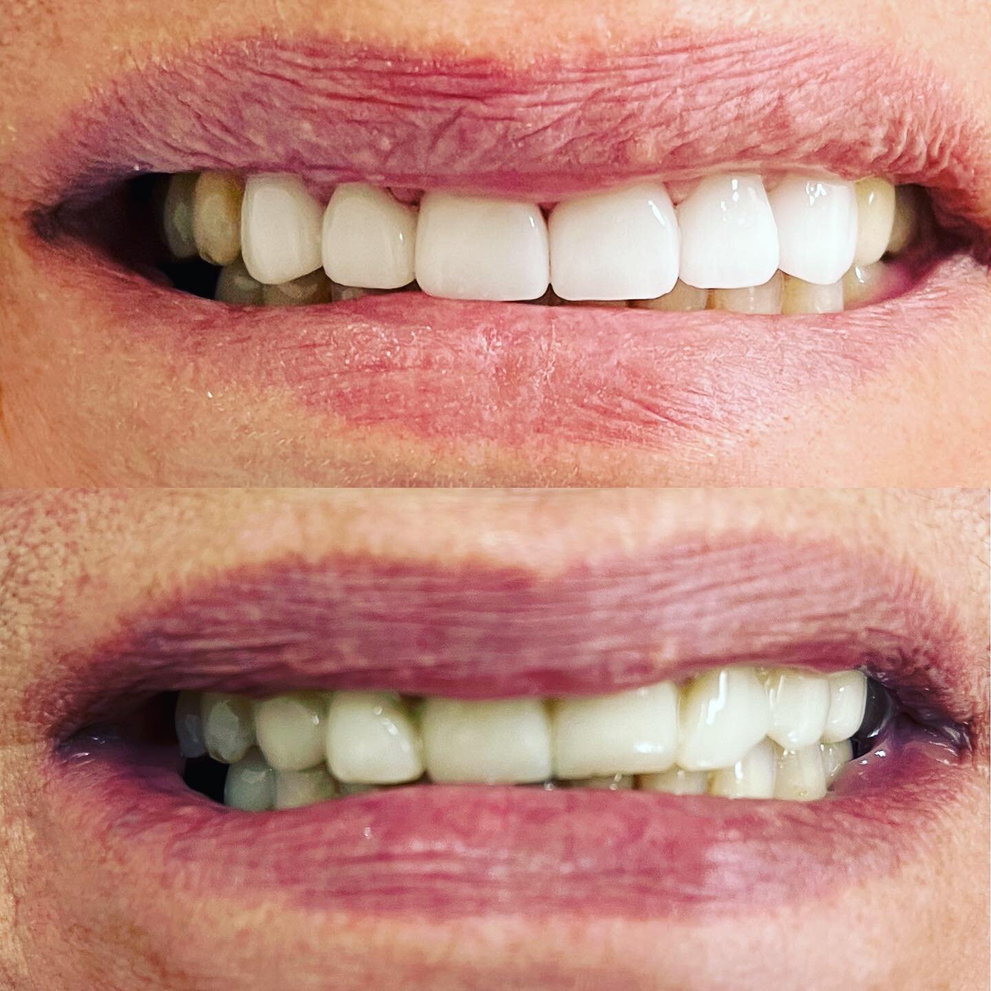 Dentists in Sherman Oaks and Panorama City | Dr. Ron Nourian DDS — Ron ...