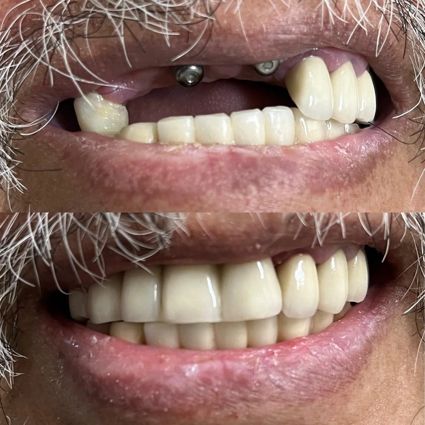 Dentists in Sherman Oaks and Panorama City | Dr. Ron Nourian DDS — Ron ...