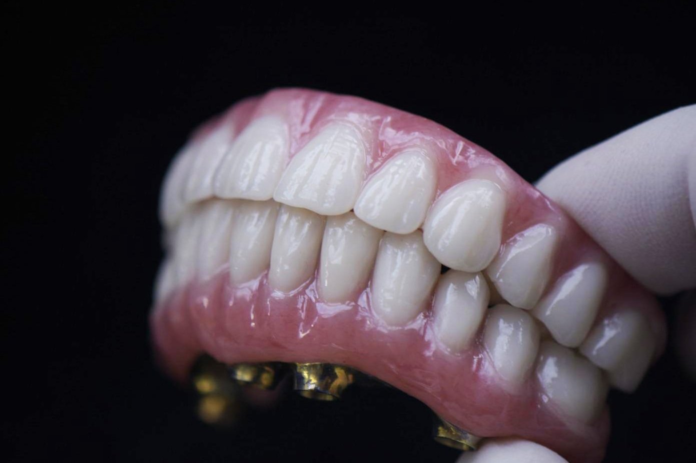 All-on-X — SparX Lab