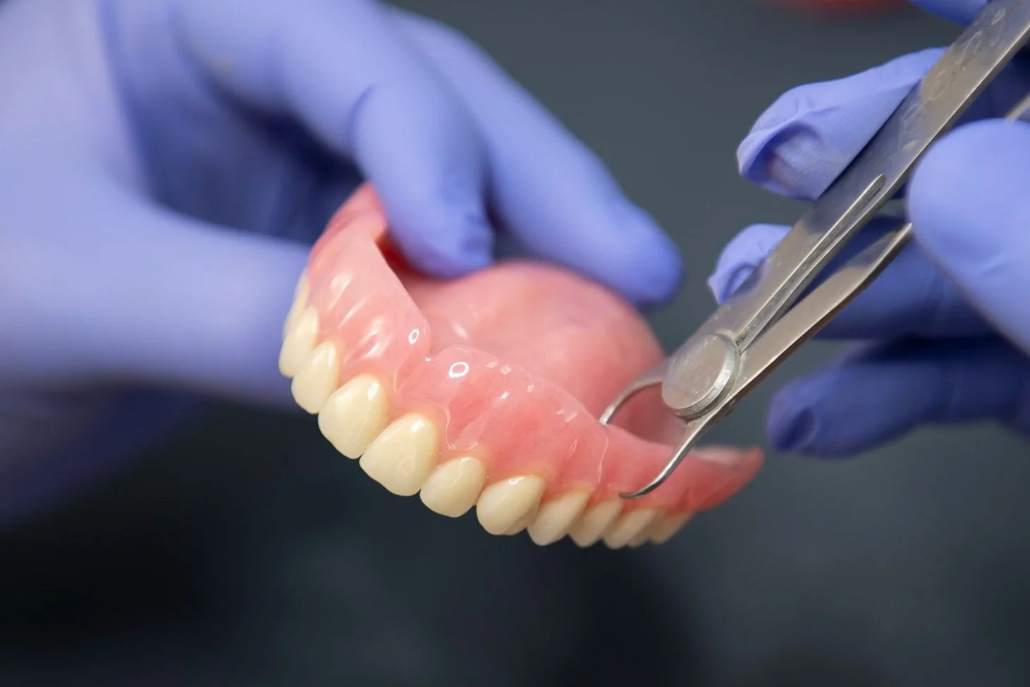 Dentures — SparX Lab