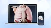 VOKA says its 3D Anatomy & Pathology app now has 100,000 active monthly ...
