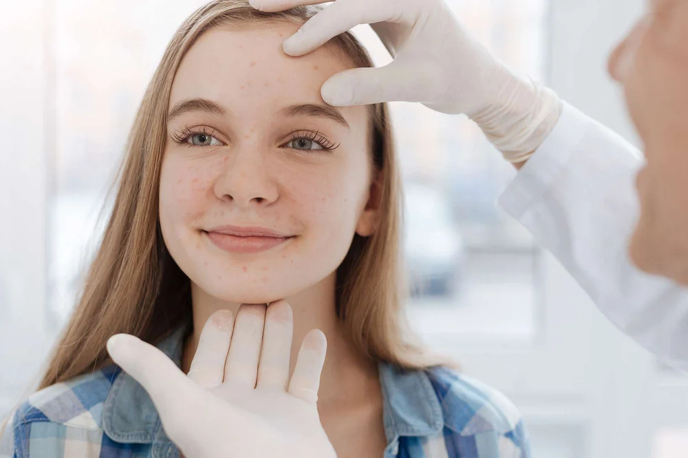 Acne — Dermatology of North Asheville