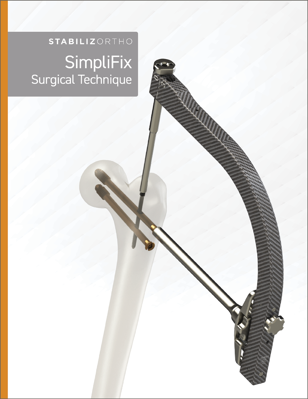 SimpliFix-Procedure — StabilizOrtho
