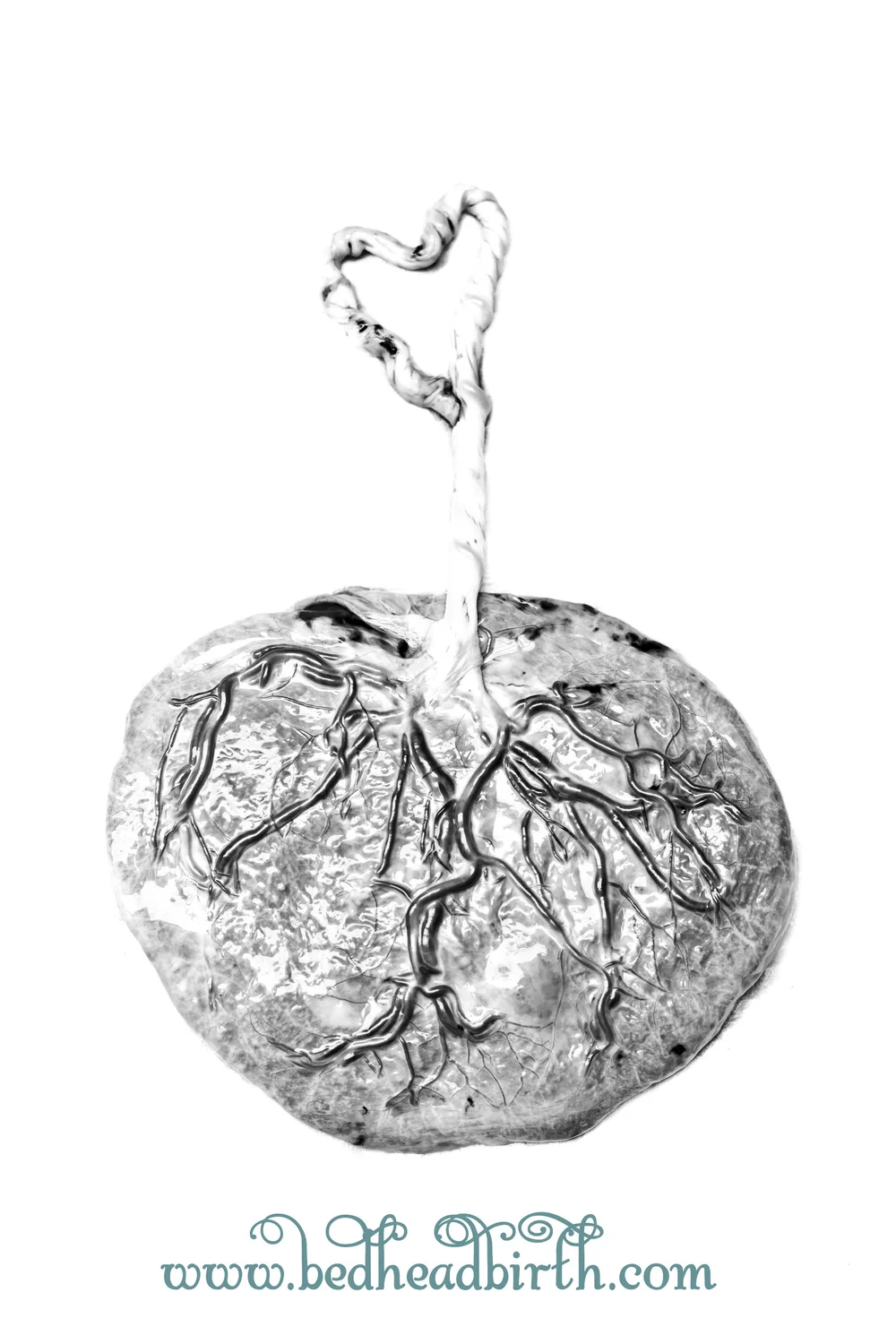 Real Talk about Placenta Encapsulation — Nikki Williams, CPM: Central ...