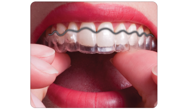 ClearCorrect — Transforming Orthodontics
