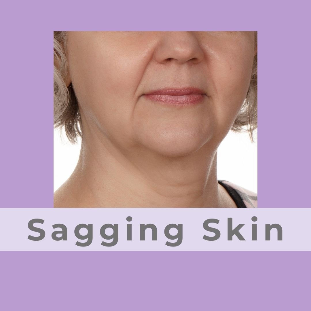Sagging Skin — Jane Long Wellbeing