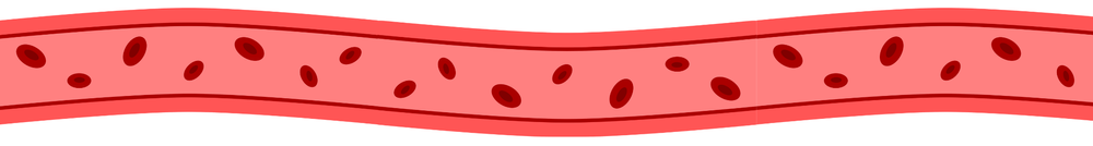 Map Mean Arterial Pressure The Circulating Scrub