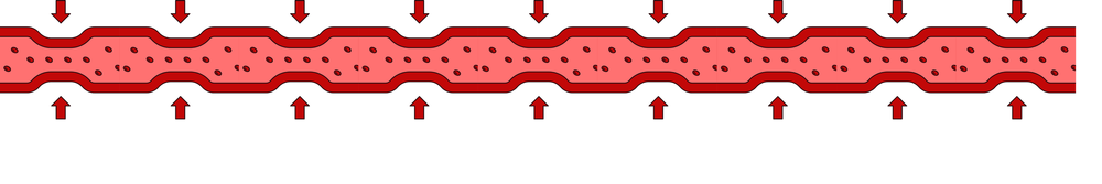 A Beginner’s Guide to Norepinephrine (Levophed) — The Circulating Scrub