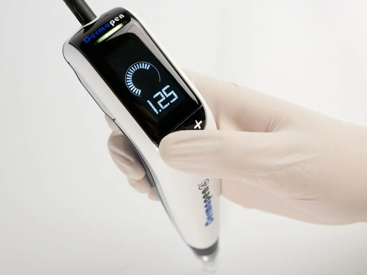 Dermal Needling — OFF & ON