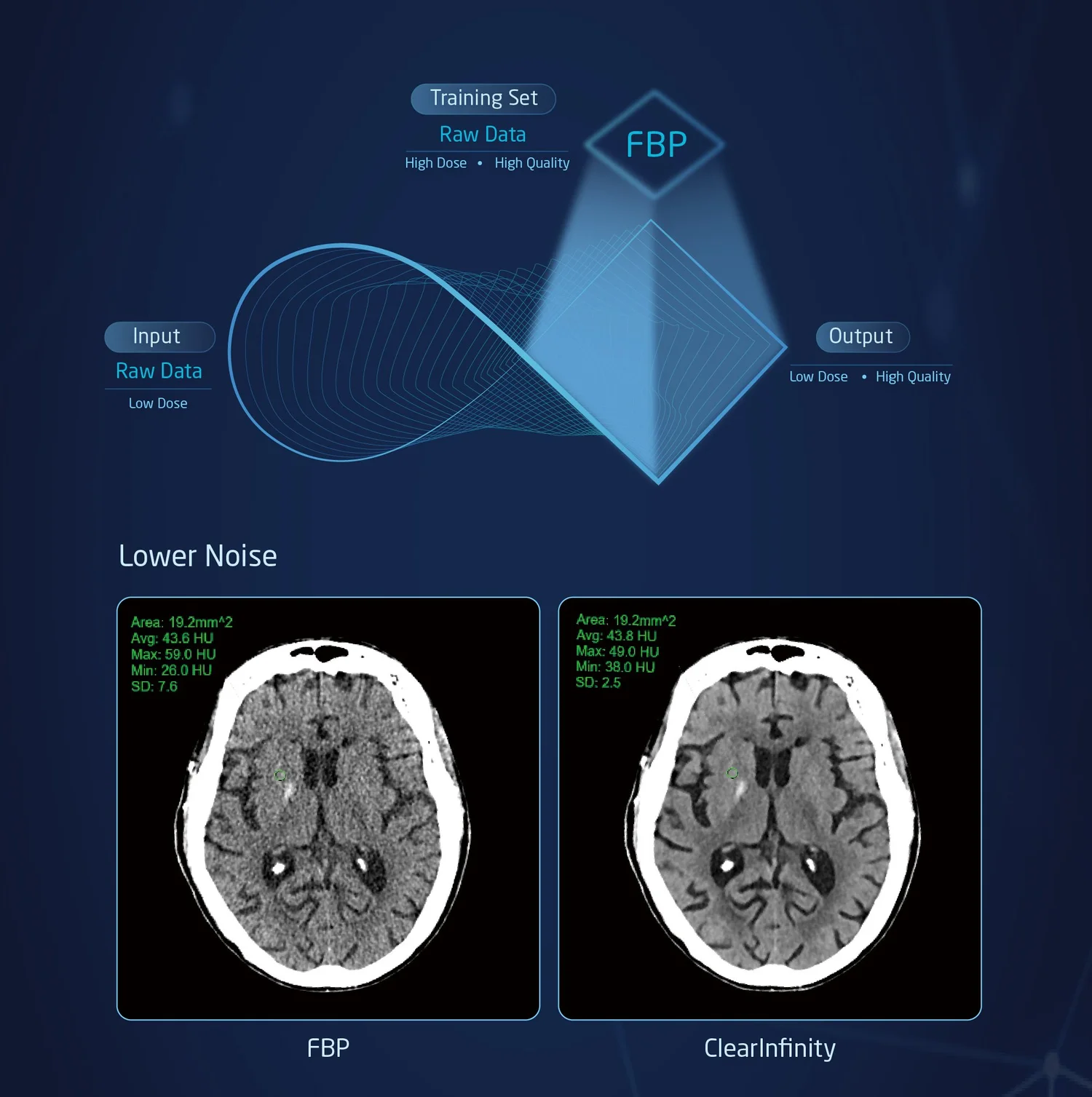 NeuViz 128 — Neusoft Medical USA