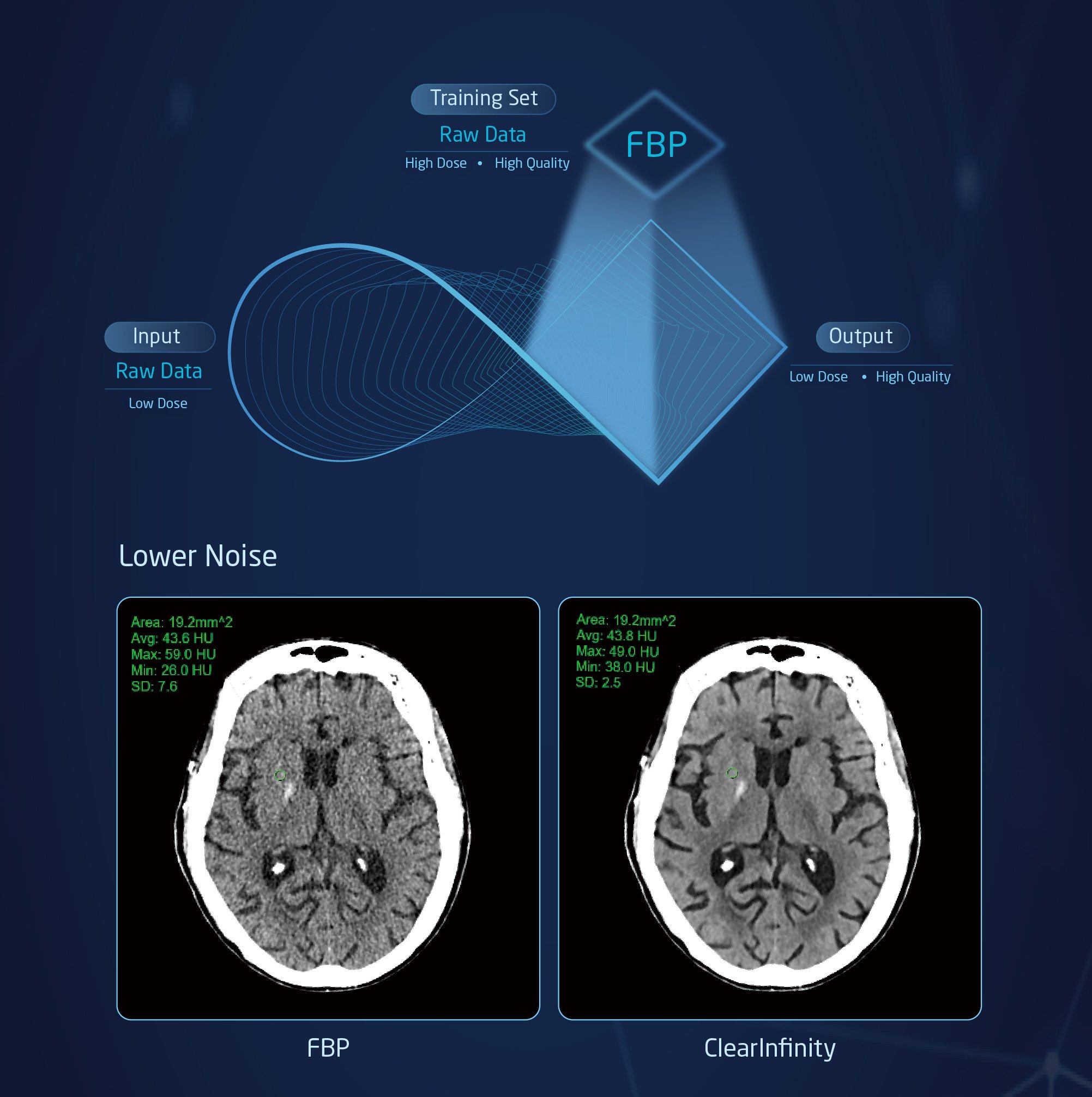NeuViz 128 — Neusoft Medical USA