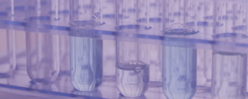 Porphyria Diagnosis — United Porphyrias Association