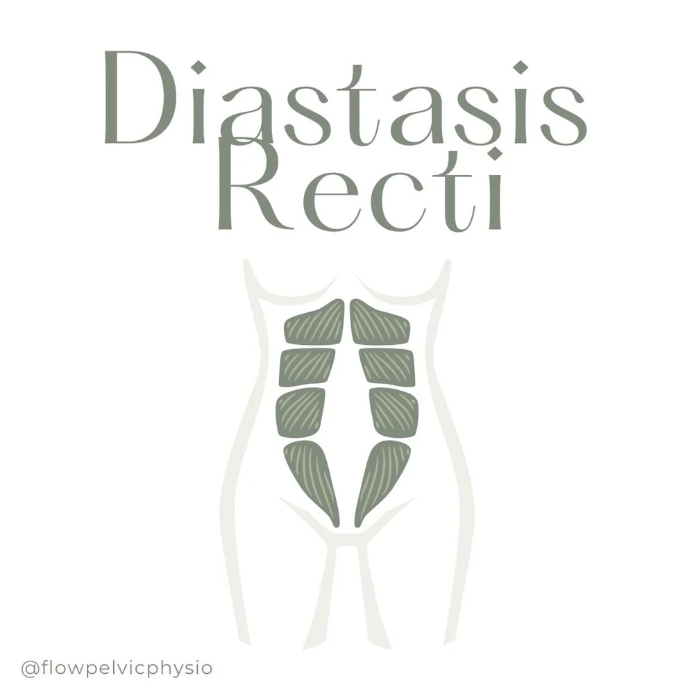 Ab separation - diastasis recti core — Flow Pelvic Physio - Pelvic ...