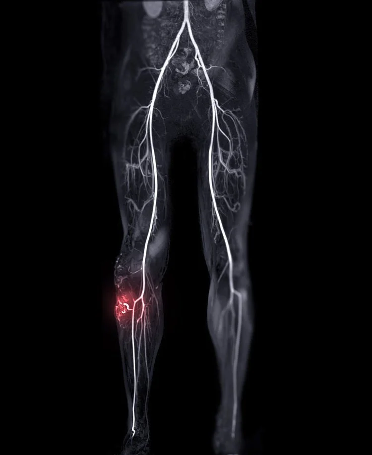 Oklahoma Vascular and Embolization Center by Flex Medical Group