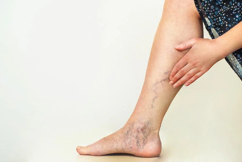 Oklahoma Vascular and Embolization Center by Flex Medical Group