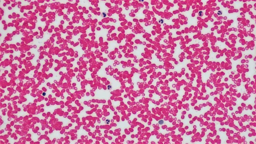 My Dog Tested Positive for Anaplasma—What Happens Next? — Two Rivers ...