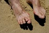 Hammer Toe Pain Specialist - Rosedale, Woodmere, Inwood, Lawrence ...