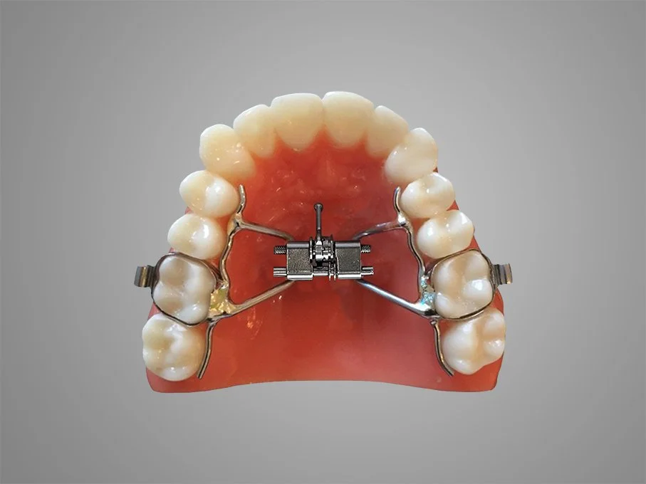 Keles Keyless Expander — Aegis Star