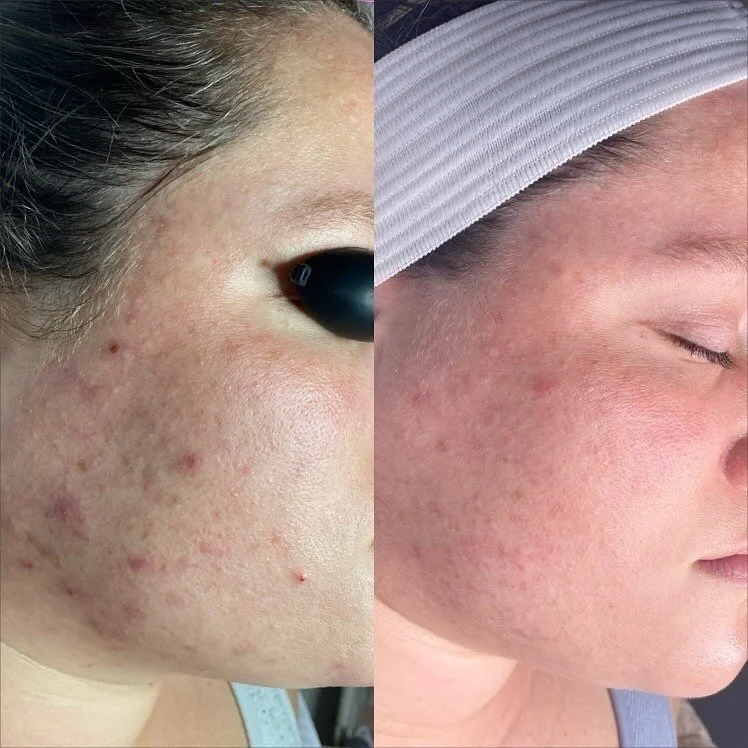 Skin Muse Aesthetics: Best Medical Aestheticians in Charlotte, NC