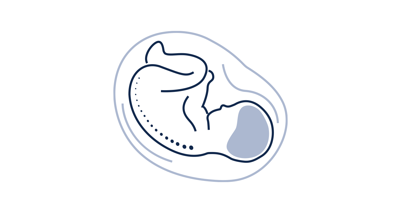 Dr Leanne Chapman | Obstetrician & Gynaecologist Brisbane