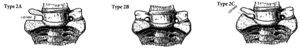 About Bertolotti's Syndrome