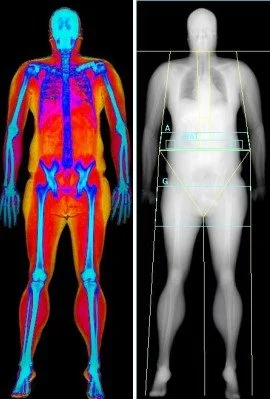 Understanding Your Dexa Body Composition Results — Health InSight
