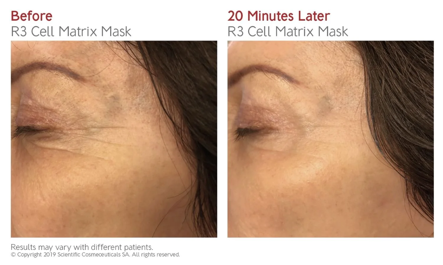 Dr. Levy Switzerland R3 Cell Matrix Mask | Aesthetic Klinik