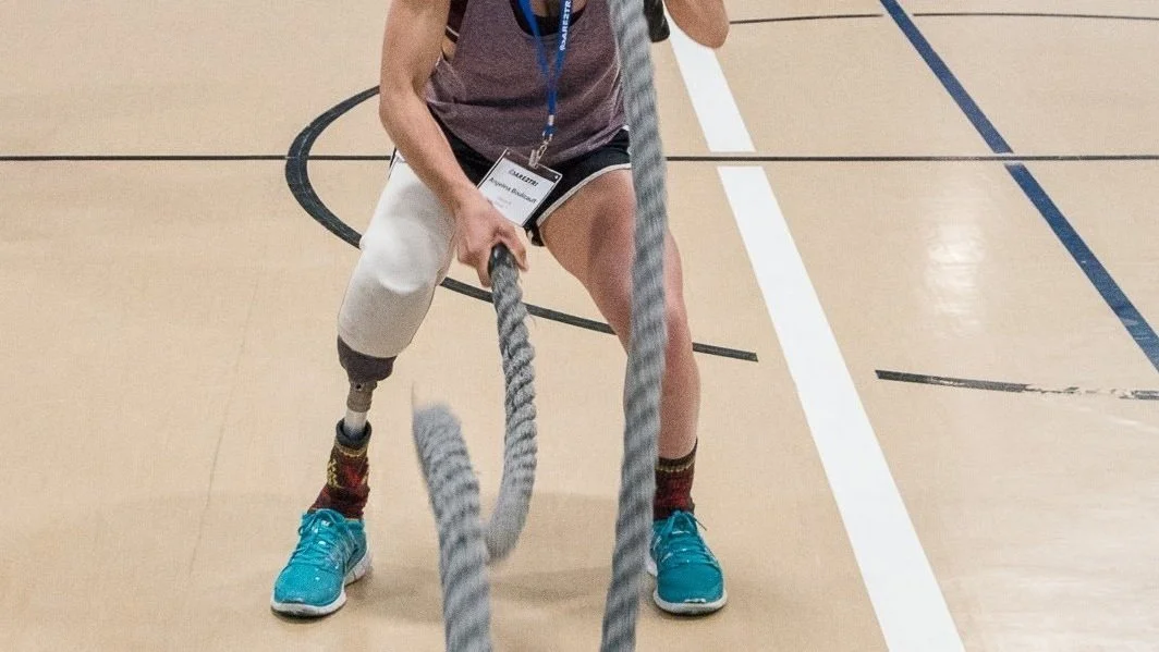 Understanding Prosthetic Suspension Options: A Guide for Upper and ...