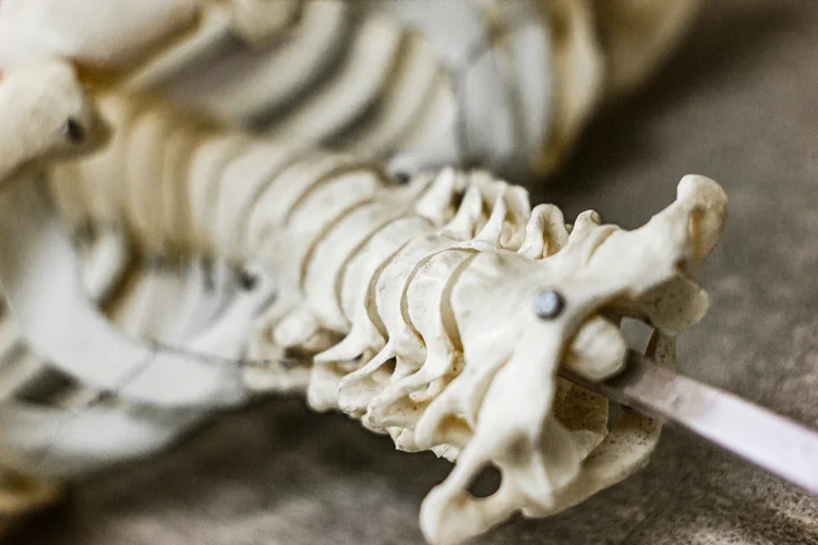 How We Treat — G. Katsevman, MD | Neurosurgeon & Spine Surgeon | Naples, FL