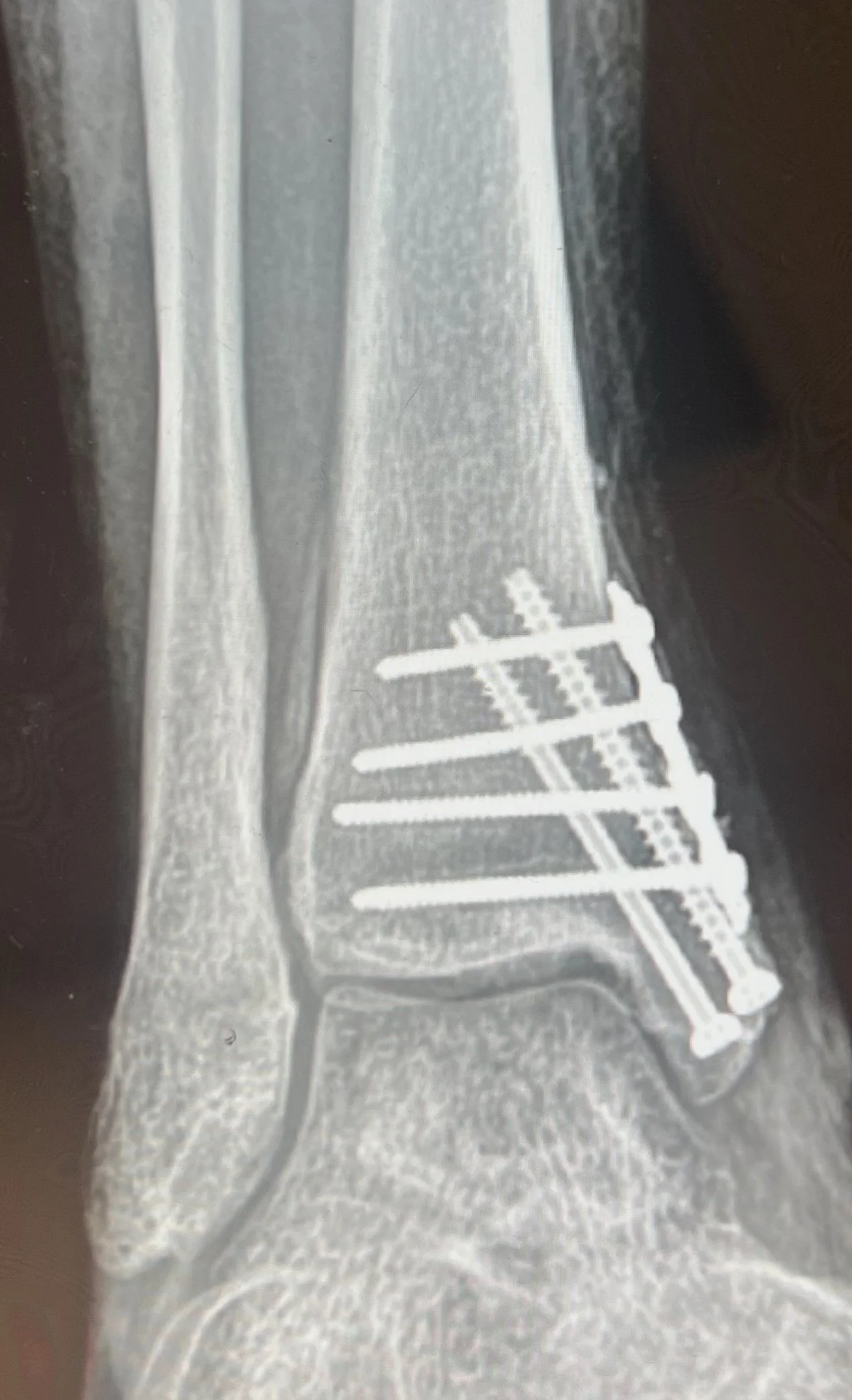 Arkansas Bone & Joint