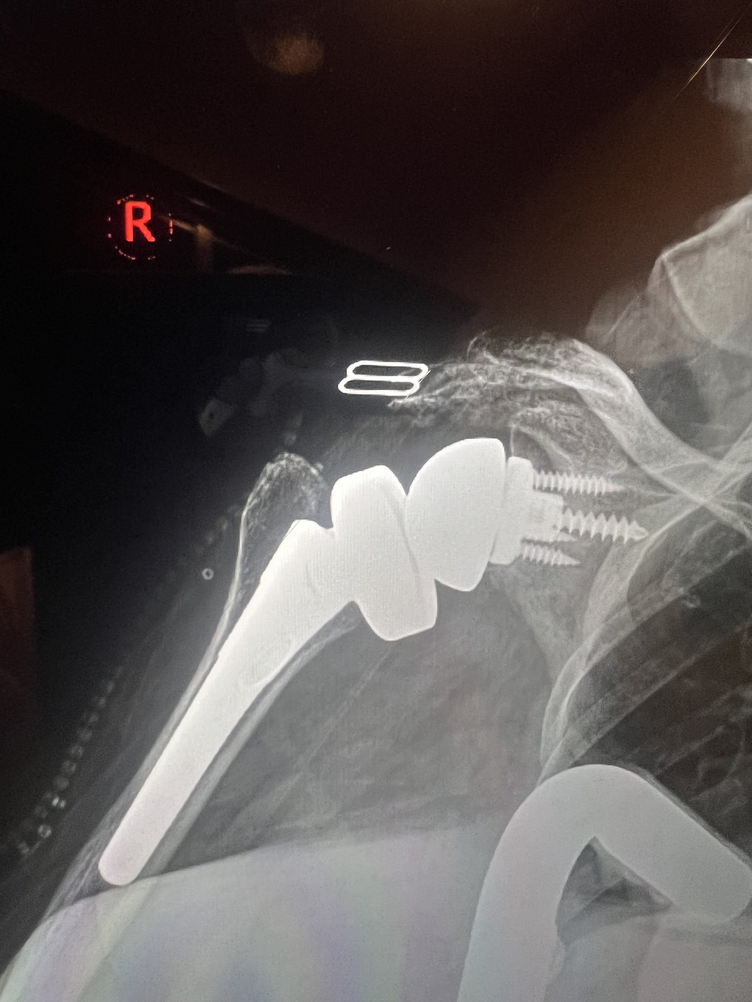 Arkansas Bone & Joint