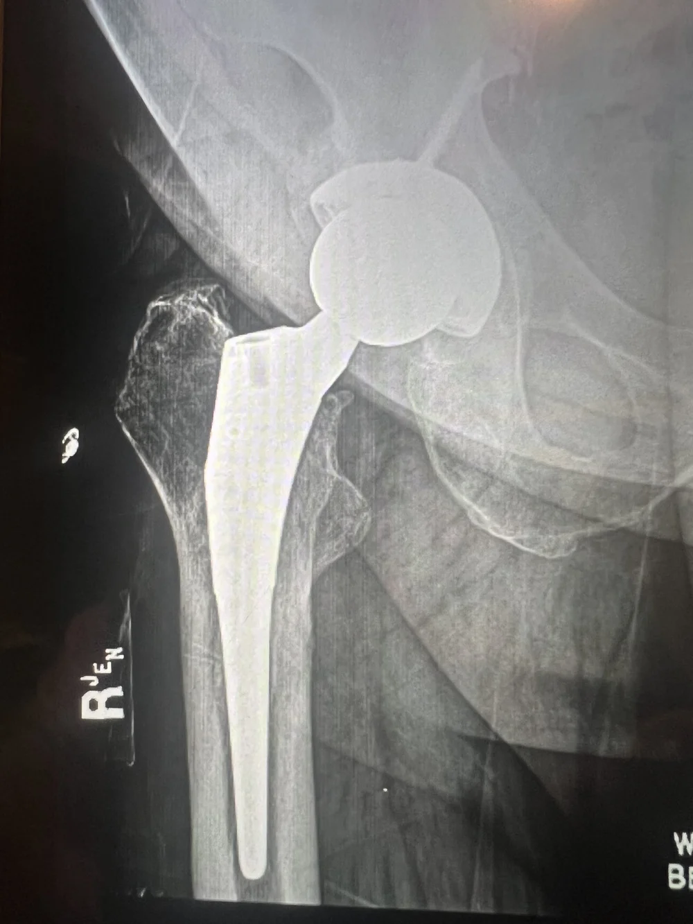 Arkansas Bone & Joint