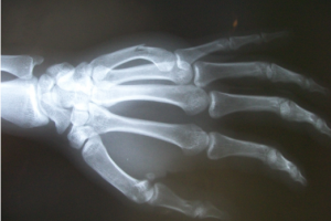 Arkansas Bone & Joint