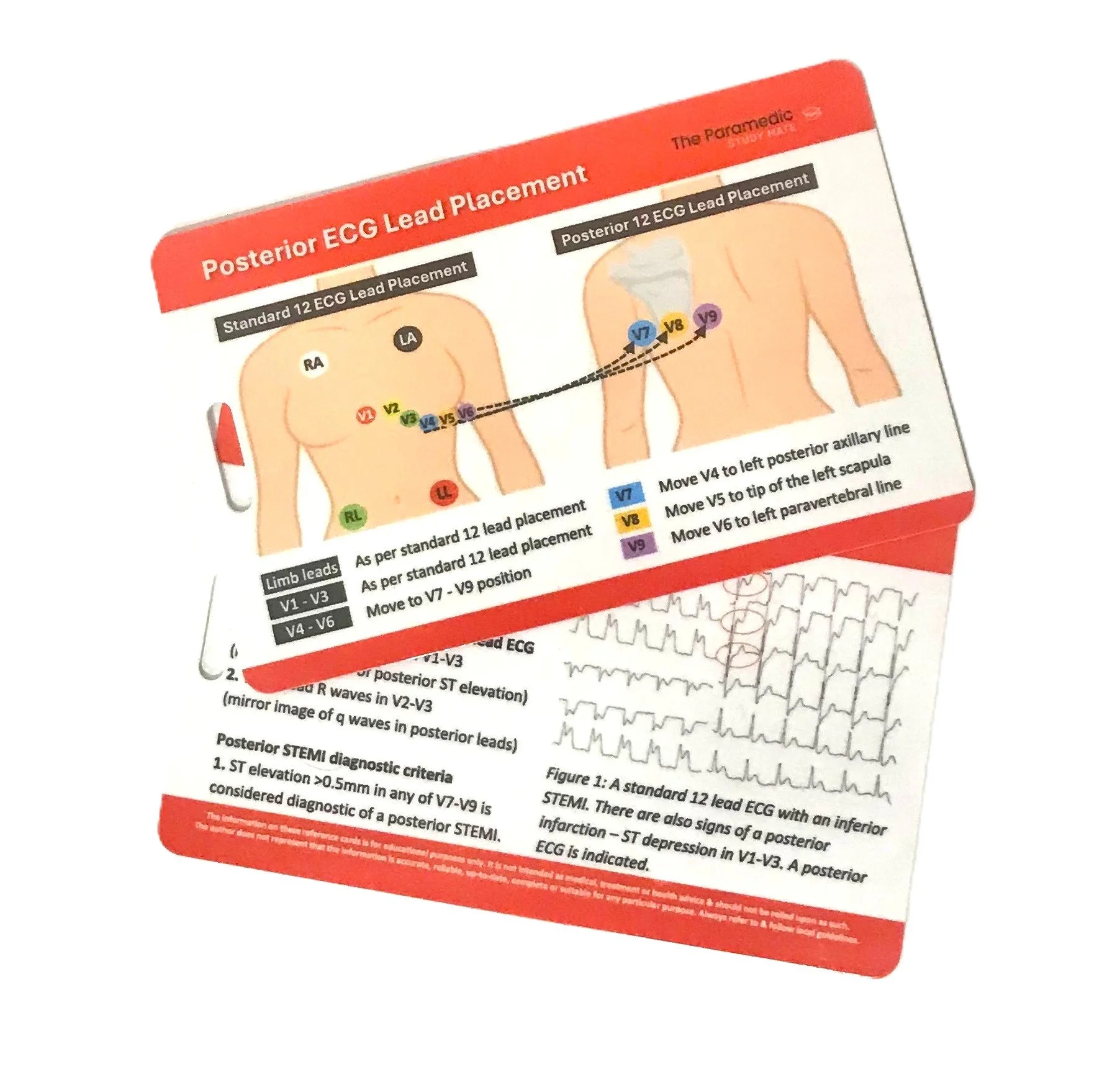 Cardiology Reference Cards — The Paramedic Study Mate