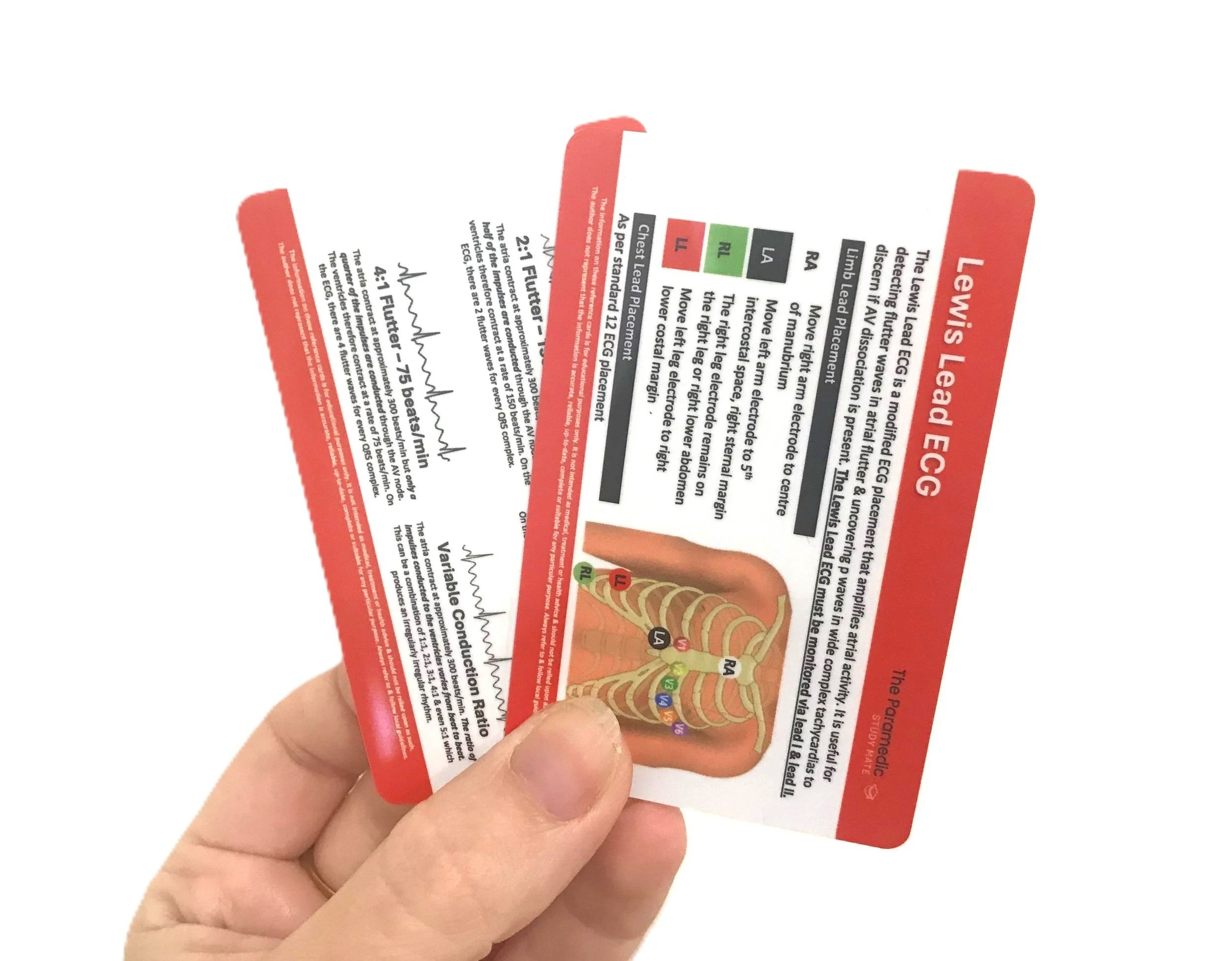 Ekg Ruler SCOPE EKG Lead Placement Card - 5/12/15 Lead ECG Reference ...