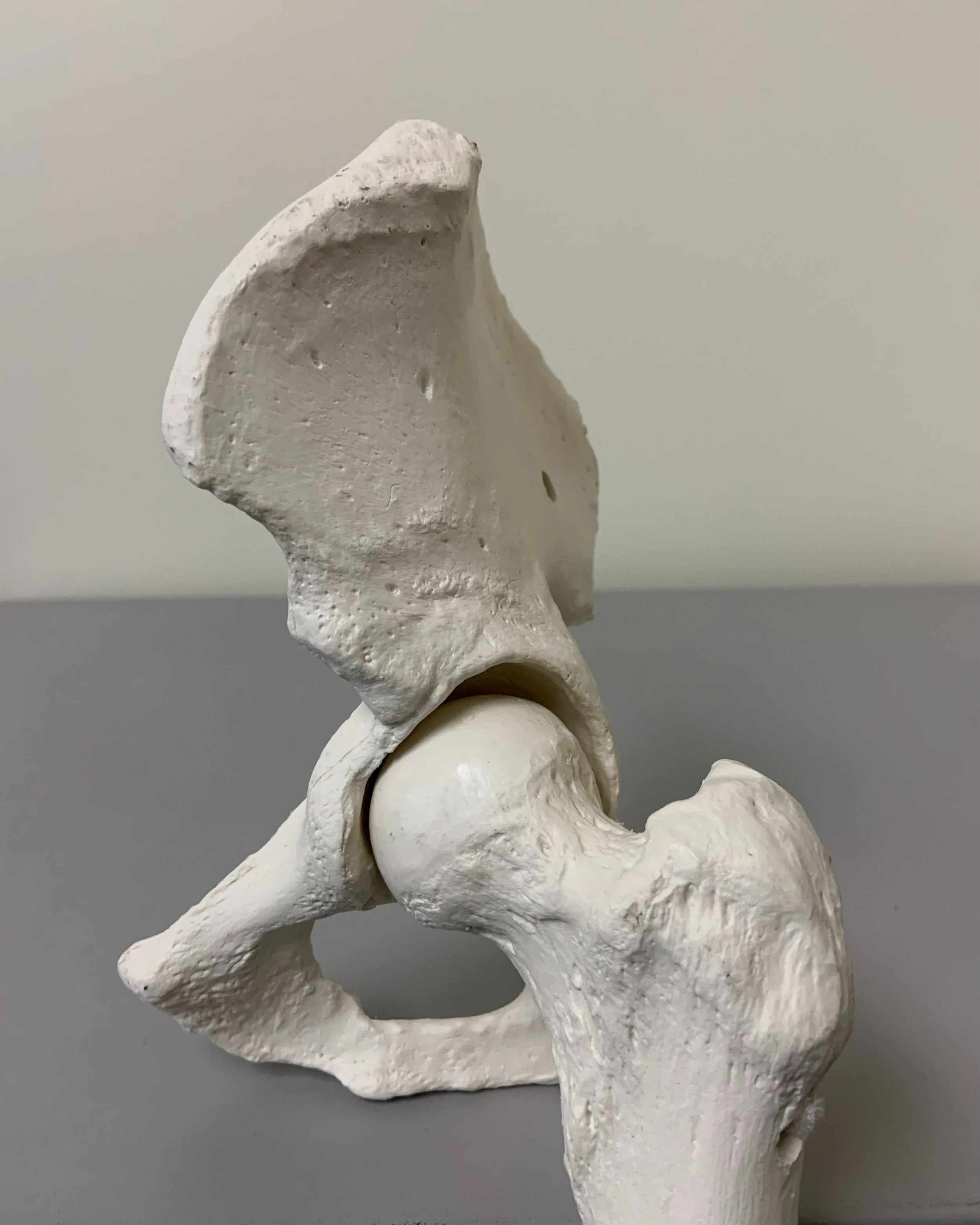 Types of Hip Replacement — Mr Murali Krishnan | Specialist Hip and Knee ...